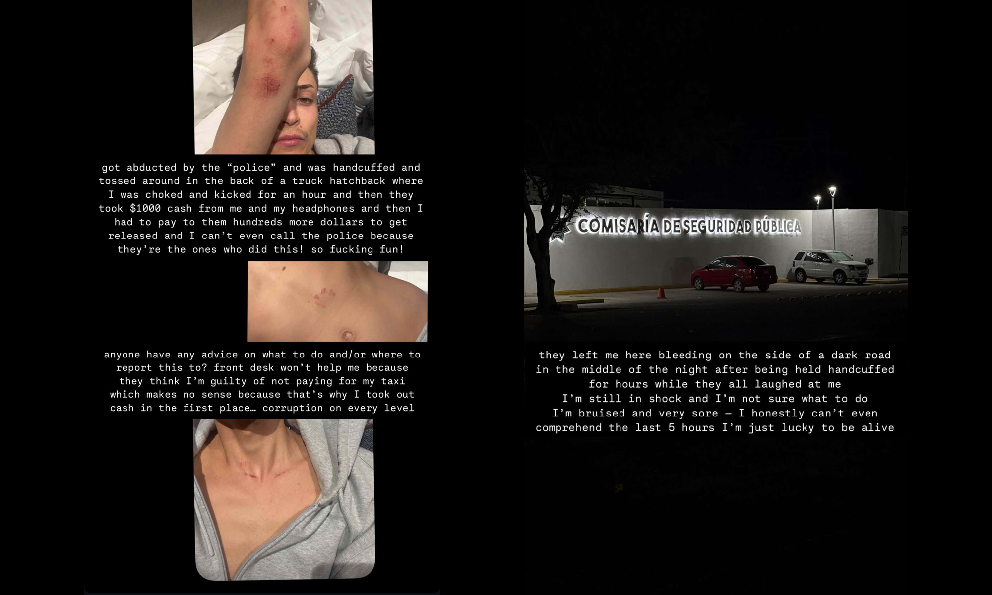 Canada's Drag Race Winner Venus Says Police In Mexico Brutally Attacked ...